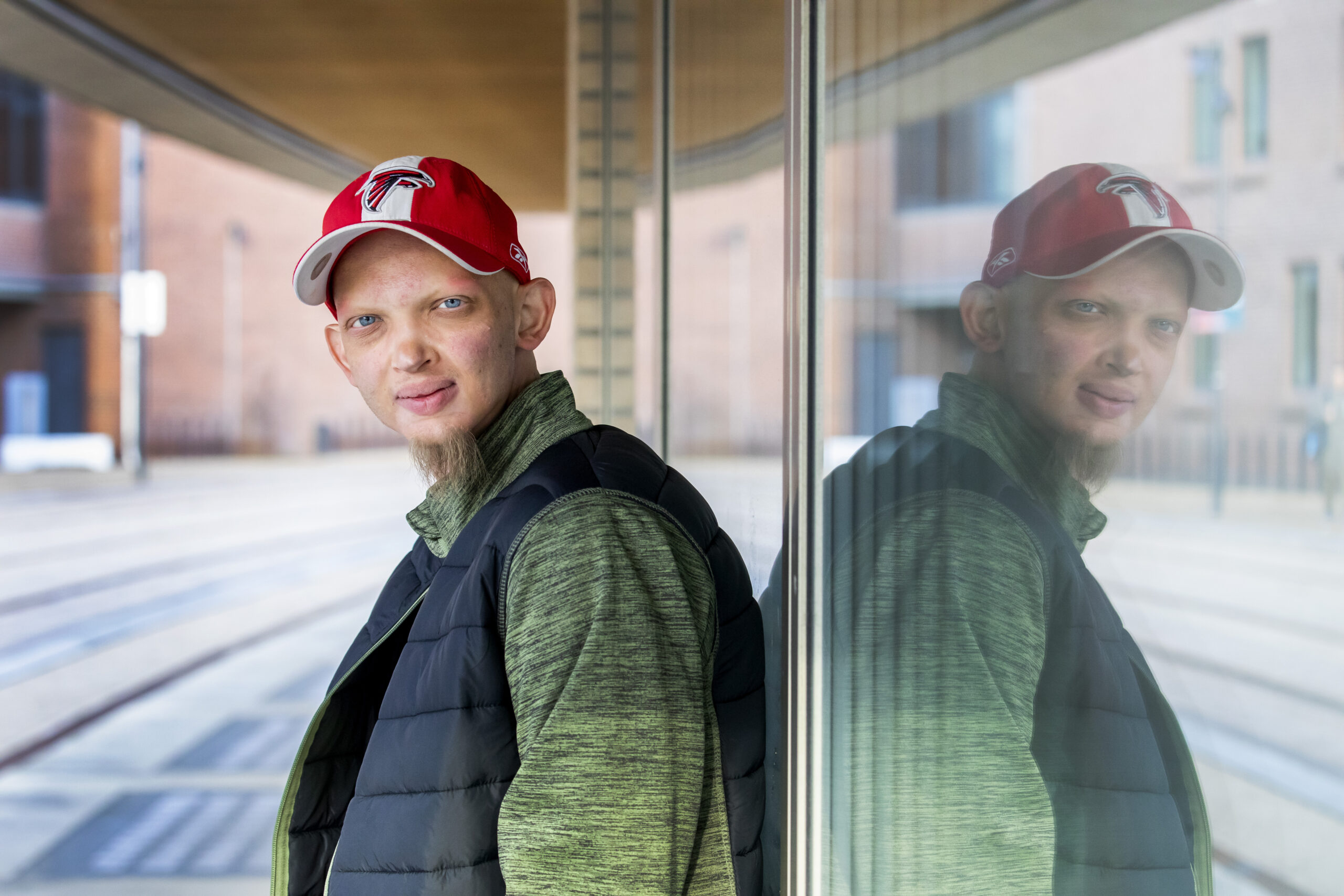 Sjældne-fortælling: For mig er det normalt at være anderledes - Sjældne ...